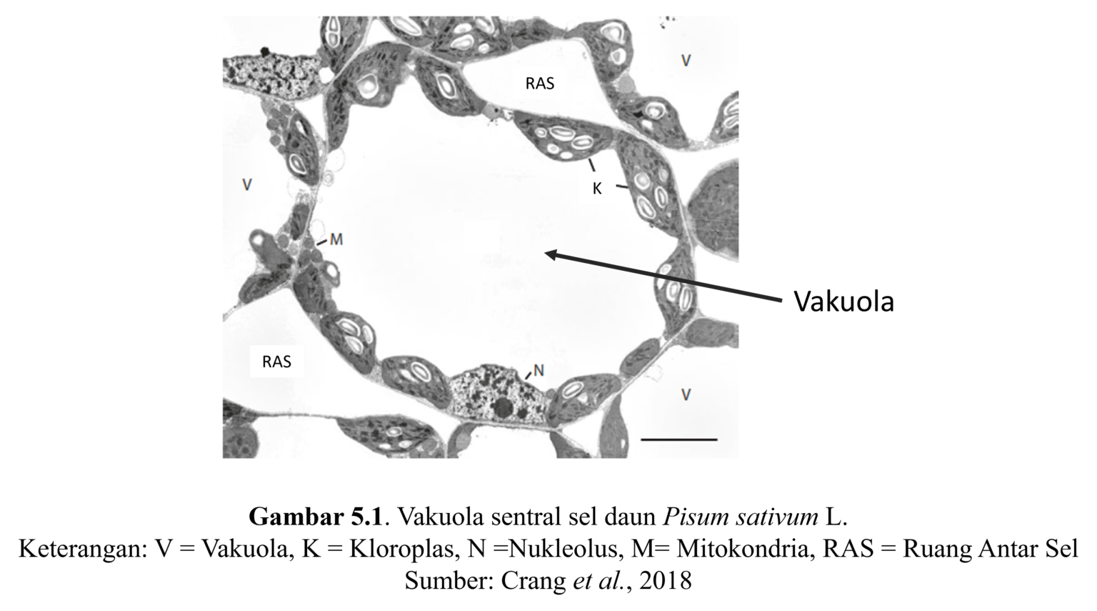 Vakuola – Belajar Sel Tumbuhan
